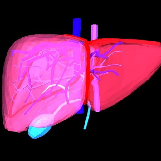 🩻 3D Models of Liver Disease - bundle - 6 pack・ STL File for 3D ...