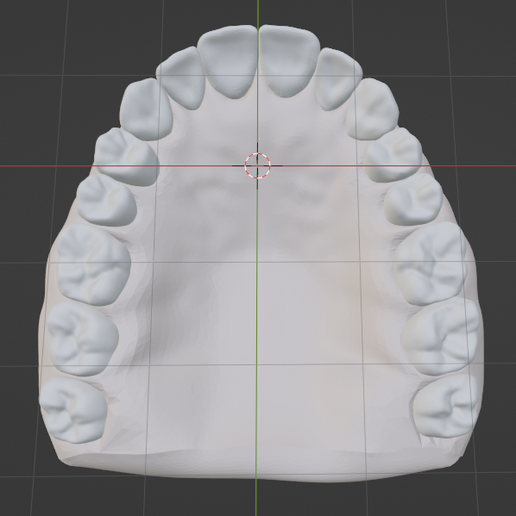 🦷 3 PARTS PENDEX DISTALIZER ON UPPER TEETH DENTAL APPLIANCE・ STL File ...