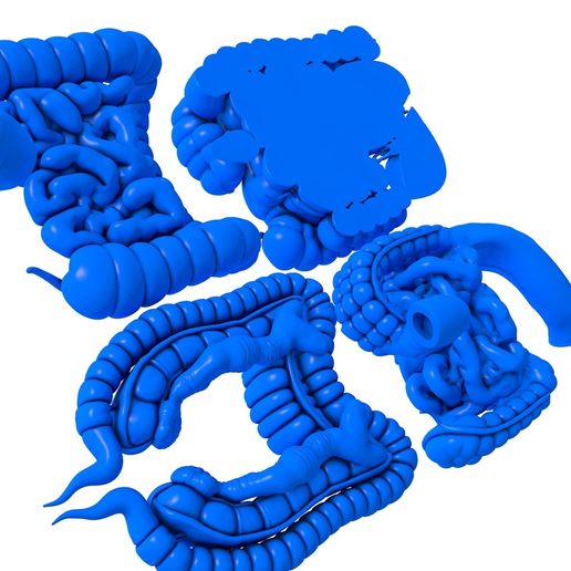 🧑‍⚕️ intestine / bowel / bowel stl / Colon diverticulitis / anatomy ...