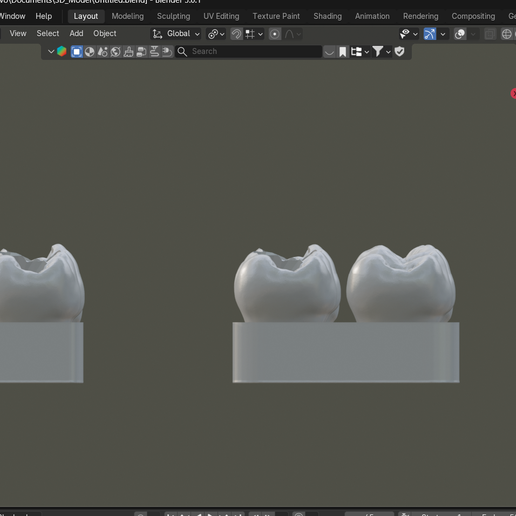 🦷 Dental Restoration Practice Set - Lower Posterior Teeth (4-7) STL ...