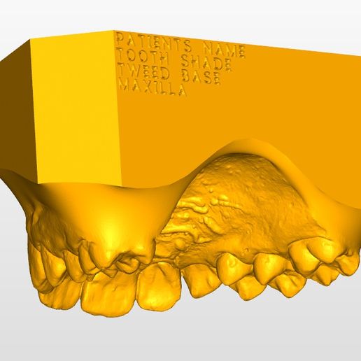 STL file Maxilla and Mandible orthodontic study models with a Tweed ...