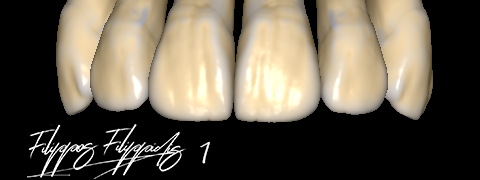 STL file Filippidis Exocad Tooth library 🦷 ・Model to download and 3D ...