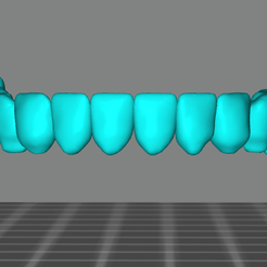 Denture best STL files for 3D printing・794 models to download・Cults