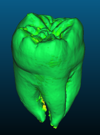 Free STL file Molar annotation 🎒 ・3D print design to download・Cults