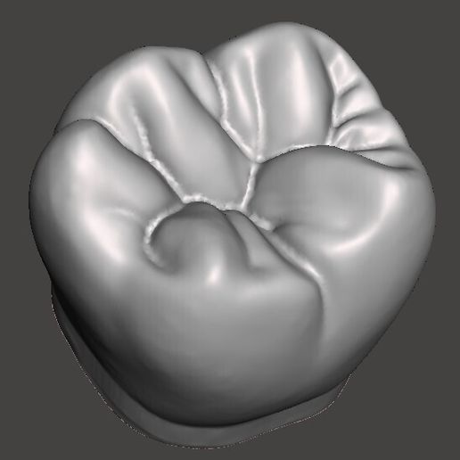 STL file Molar XL 36 🦷 ・3D print model to download・Cults