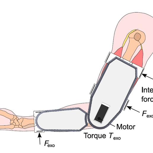 🩻 Upper Limb rehablitation device・ STL File for 3D printing・Cults