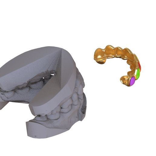 💀 grillz 3D print model・ STL File for ・Cults