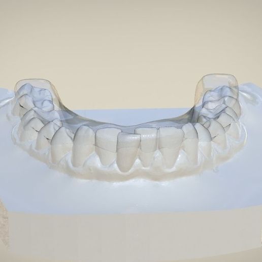 STL file Flat Occlusal Plane Splint 🛩️ (OBJ, 3MF, and DWG)・3D printable ...