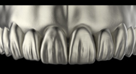 👑 The complete set of 36 'Expression' dental libraries - Exocad・ STL ...