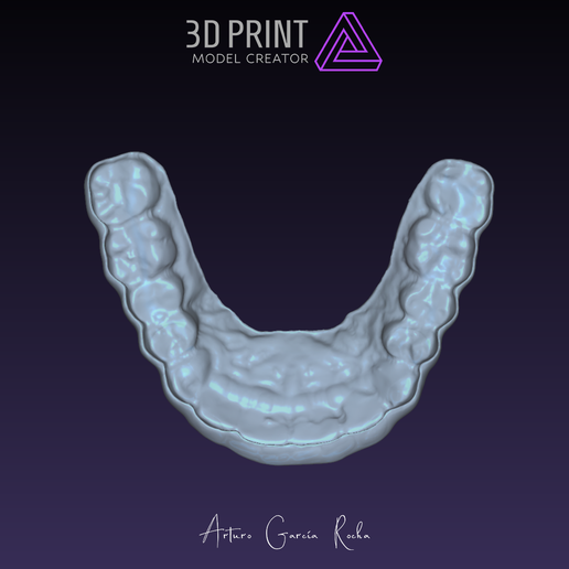STL file Restrictive dental splint 👑 ・3D printable model to download・Cults