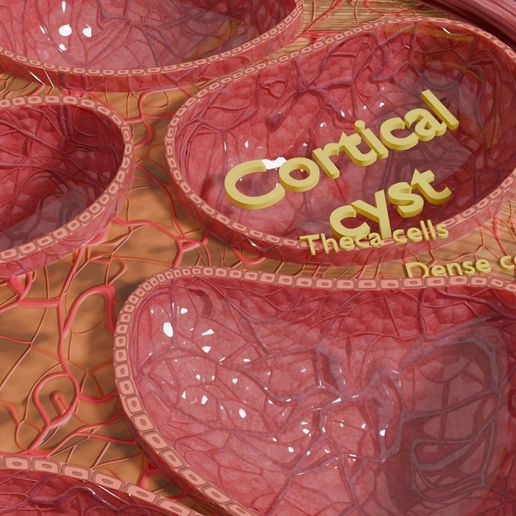 ⚕️ Polycystic Ovary Disease PCOD・ STL File for 3D printing・Cults