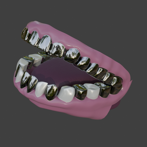 👄 Denture Grillz・ OBJ File for 3D printing・Cults